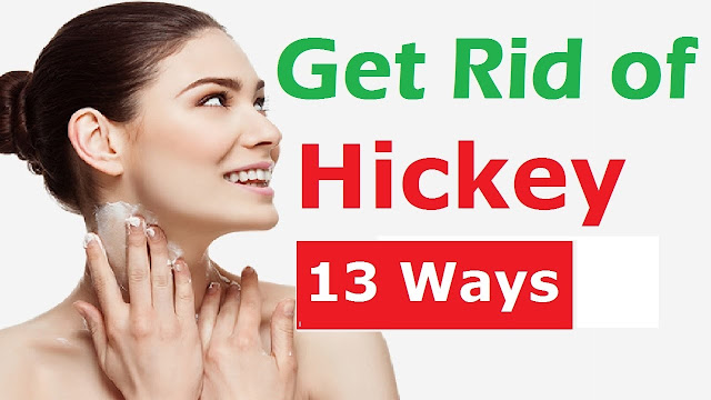 How to Get Rid of Hickeys Fast? AKA love bite or kiss mark