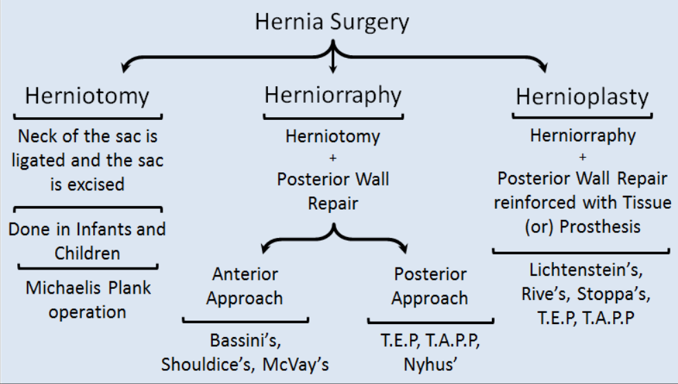 Types of Hernia Surgery.