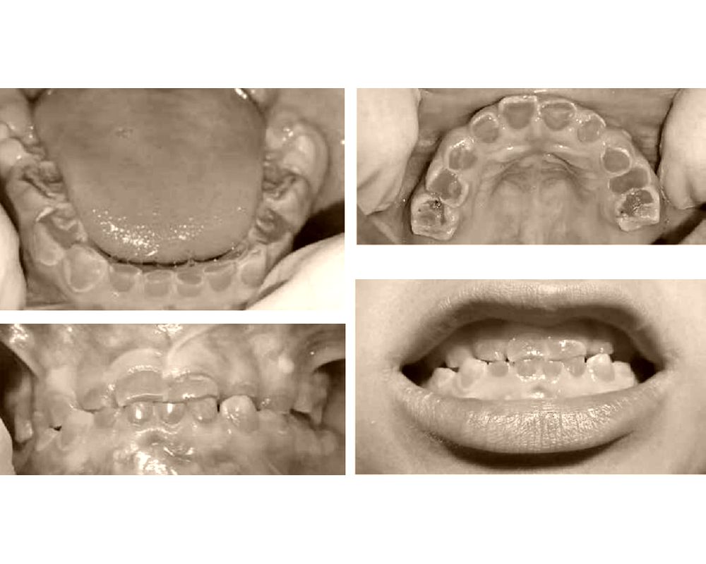 OdontoVida: Caso Clínico