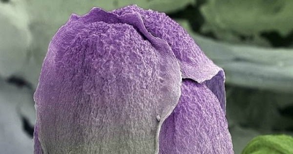 Kindergarten and Mooneyisms: Up Close - What Is It?