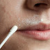 This Natural Recipe Will Make Your Upper Lip Hair Disappear Forever ...