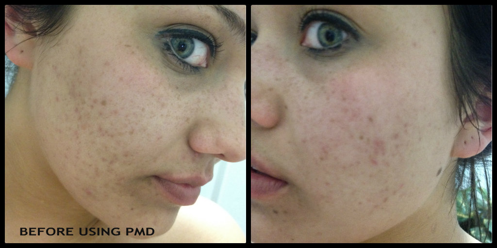 ThatGirlShaes Blog!: PMD Update
