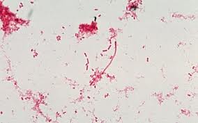 CITROBACTER - LEVINEA | Microbiologie médical