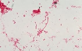 CITROBACTER - LEVINEA | Microbiologie médical