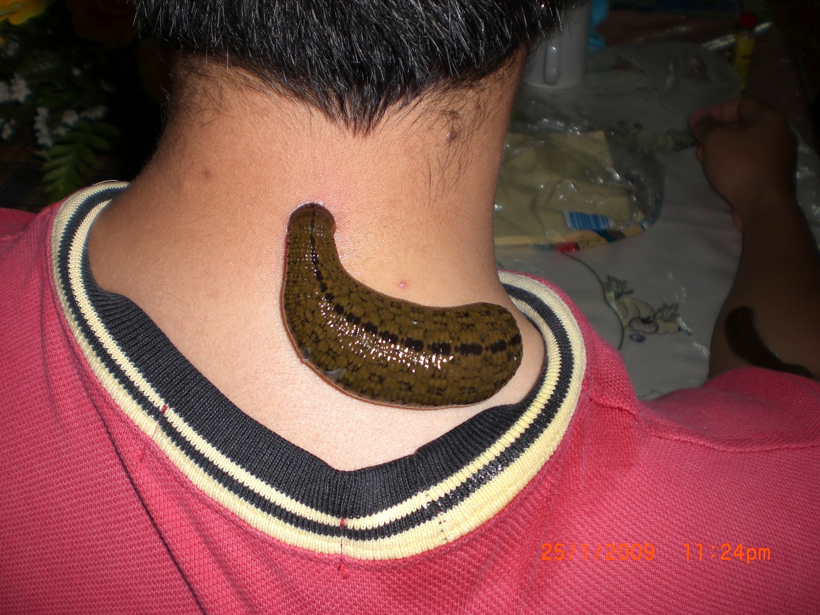 TakeCare!: LEECH THERAPY IN MALAYSIA - Painless Ancient Treatment