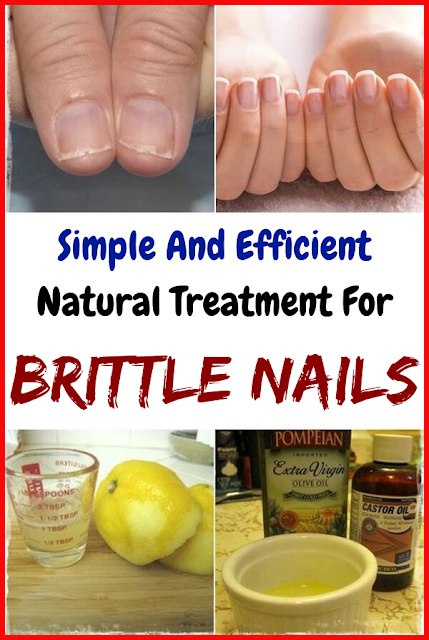 Simple And Efficient Natural Treatment For Brittle Nails - Blackpink