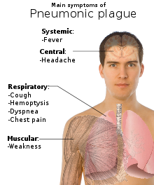 Blog do Facó: PESTE NEGRA