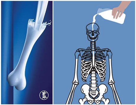 Calcio, un nutriente para nuestros huesos