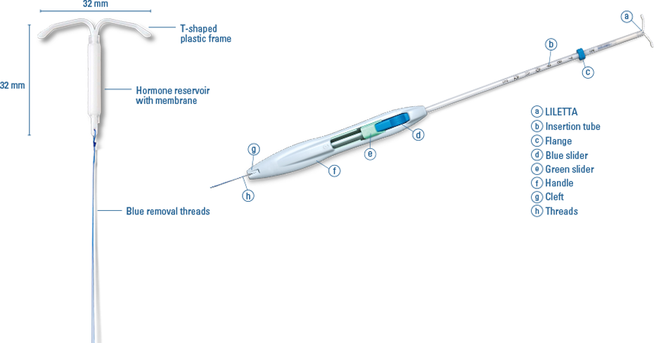 Ob/Gyn Updated : New Single Handed IUD Inserter for LILETTA released ...