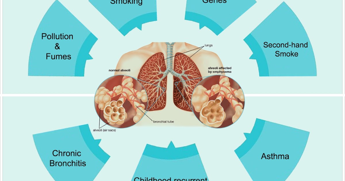 Dr. Arunesh Kumar Pulmonologist: Causes & Risk Factors of Chronic ...