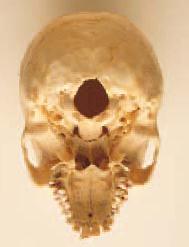 Head Case - Skull - Body Part
