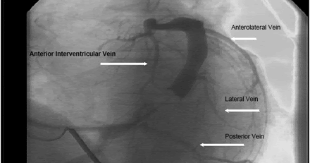 Dr Han Naung @ Henry Han : Electrophysiology and Heart Rhythm ...