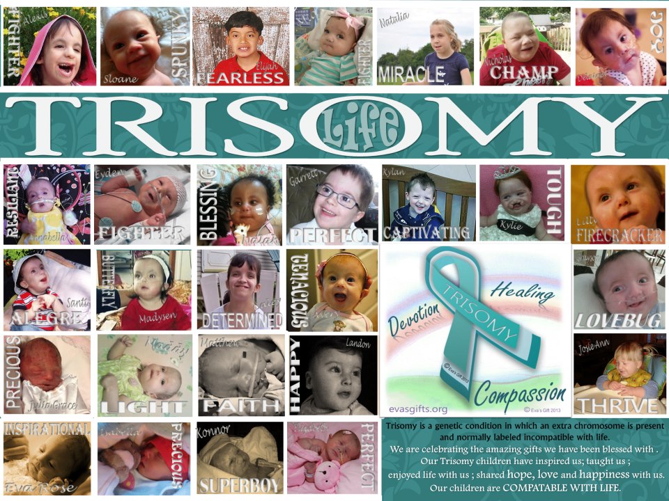 Pray For Lilly: Putting Faces to Trisomy Awareness