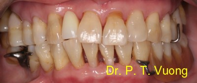 Dr. Phuoc Vuong Dentist - Phuoc T. Vuong, DMD, MS - Dr. Phil T. Vuong ...