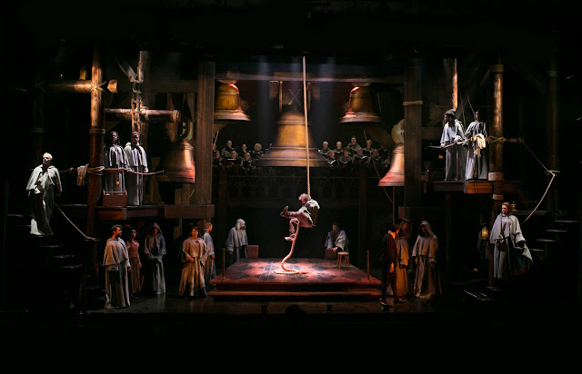 Collection Of Real Hunchback People Real Life Hunchback