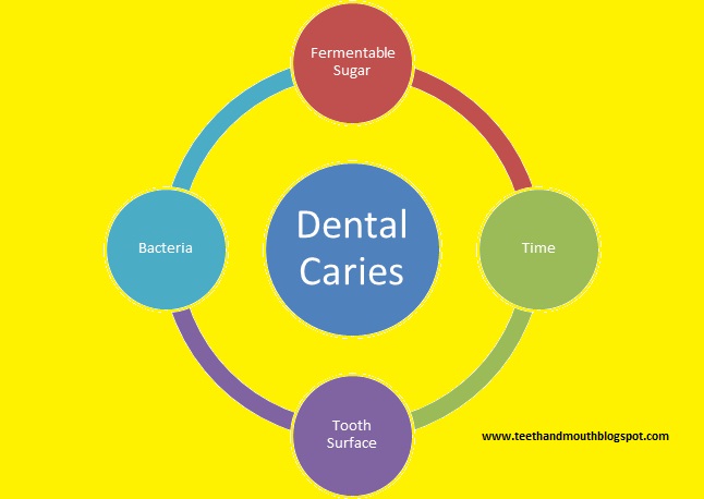 dental zone: Tips on Dental Caries