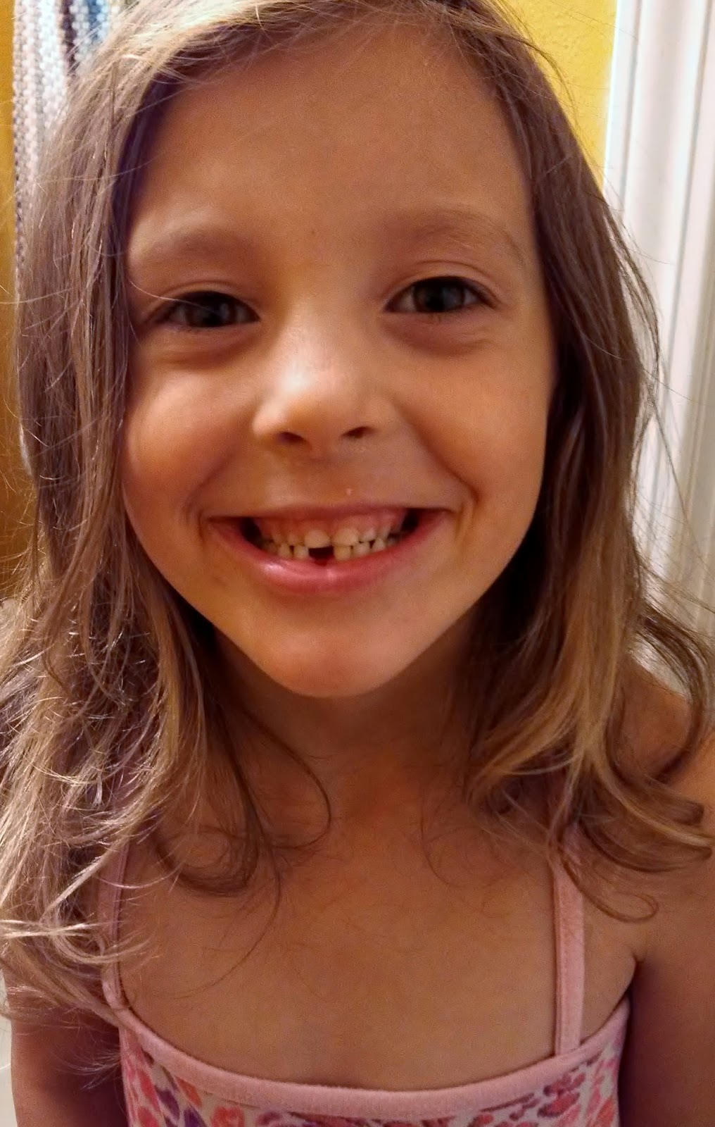First tooth down. Many more to come...
