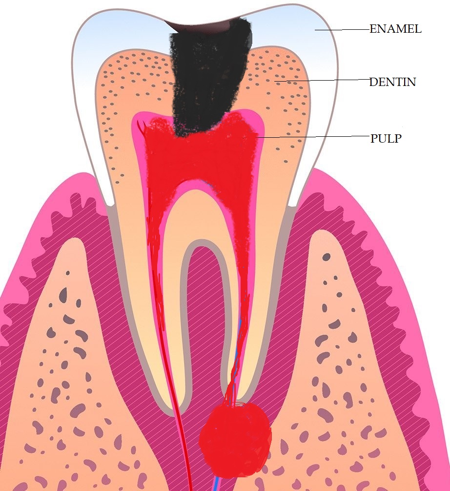 Know how you are responsible for your Dental treatment expenses!
