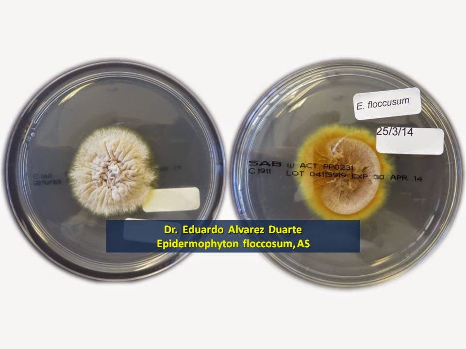 Micelio: Epidermophyton floccosum