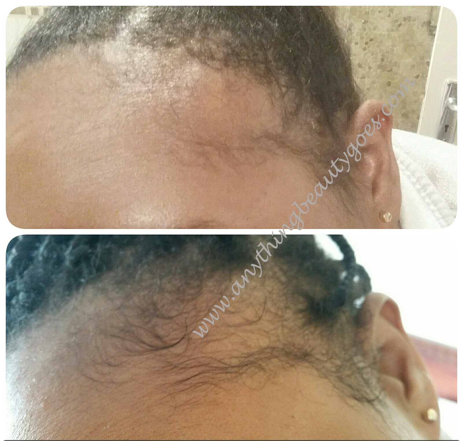 Another review: Feso - the natural hair growth aid