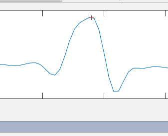 Muscle Oxygen Training: Movesense Medical ECG V2.0 Firmware brief review