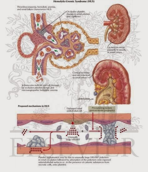Team-the-best1: Uremic syndrome