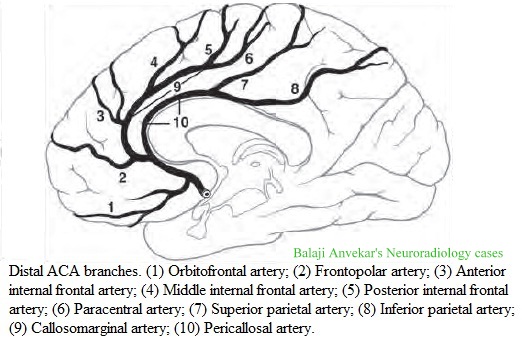 Dr Balaji Anvekar FRCR: Anterior cerebral artery
