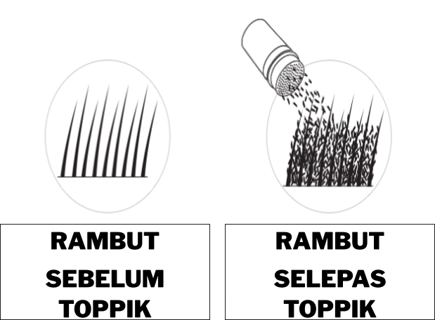 Rawatan Rambut dan Tanam Rambut Terbaik di Johor Bahru 2020