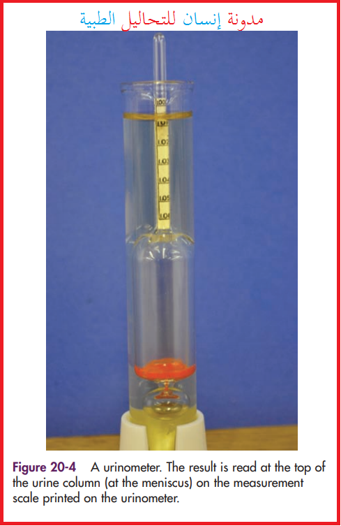 Specific Gravity of urine | Urinometer-Refractometer