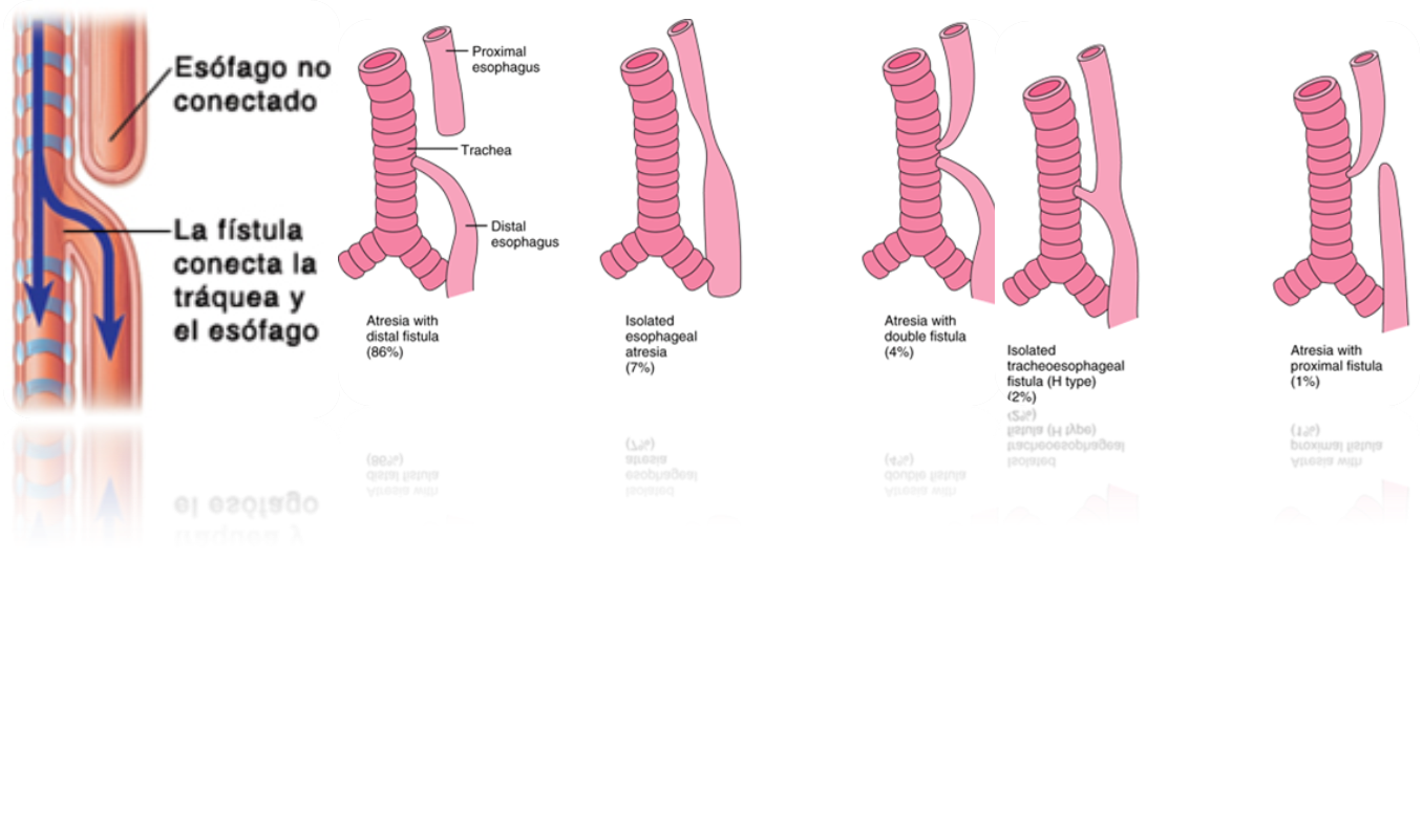 Anomalías Congénitas Respiratorias : septiembre 2013