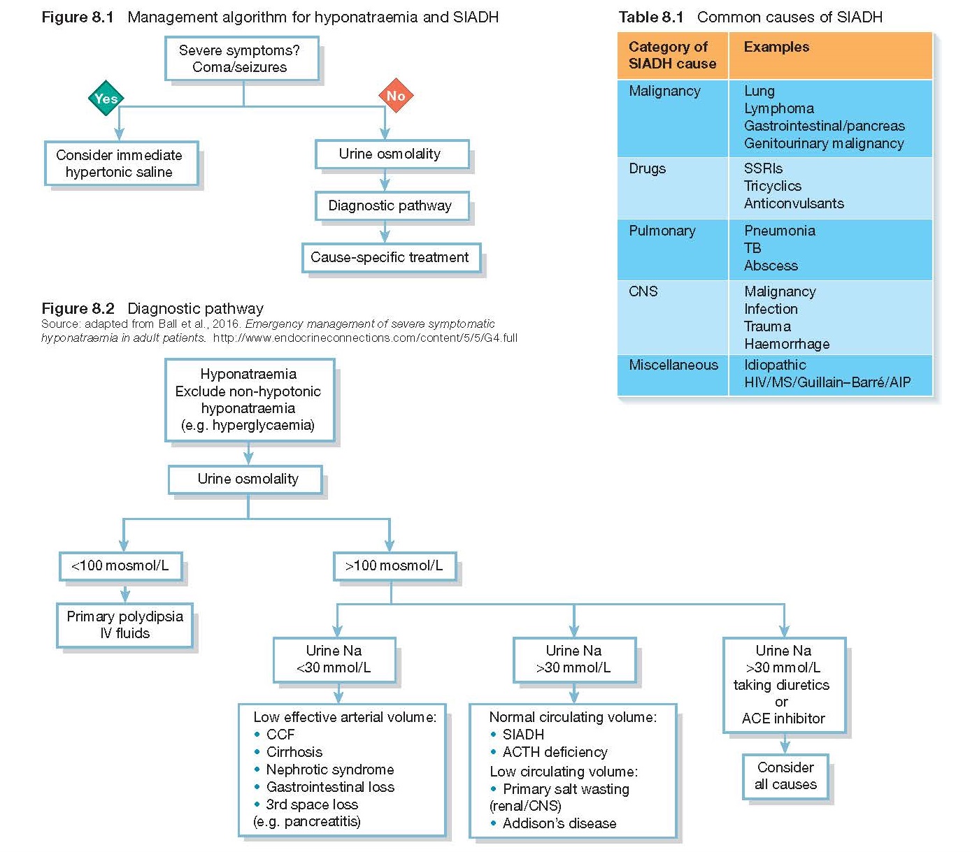 Hyponatraemia and SIADH - pediagenosis