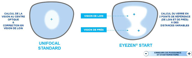 Mis Mentiras Favoritas: Las lentes monofocales nunca evolucionan ...