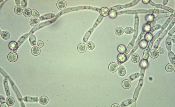 Candida sp | dyantepLog