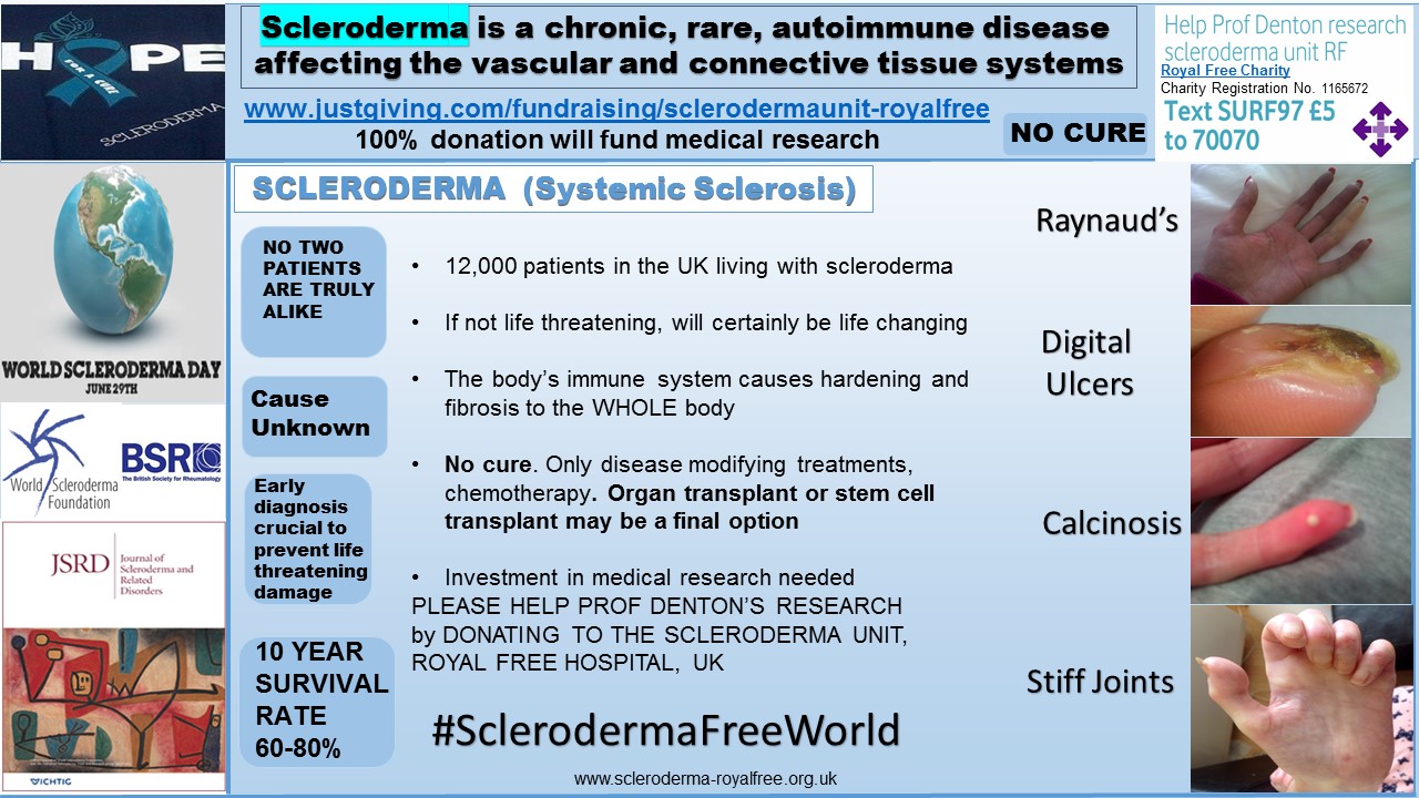 Raynauds Scleroderma Global Patients: Raynauds and Scleroderma Infographic