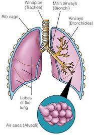 Free For Health: Bronchiectasis Definition, Symptoms And What Can Be Done