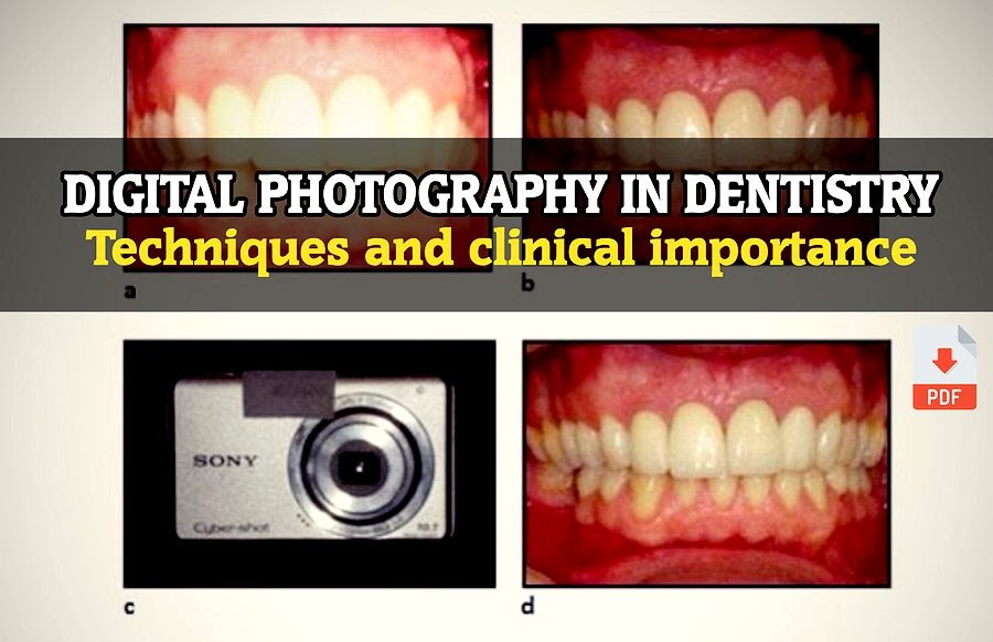 DIGITAL PHOTOGRAPHY in Dentistry: Techniques and clinical importance ...