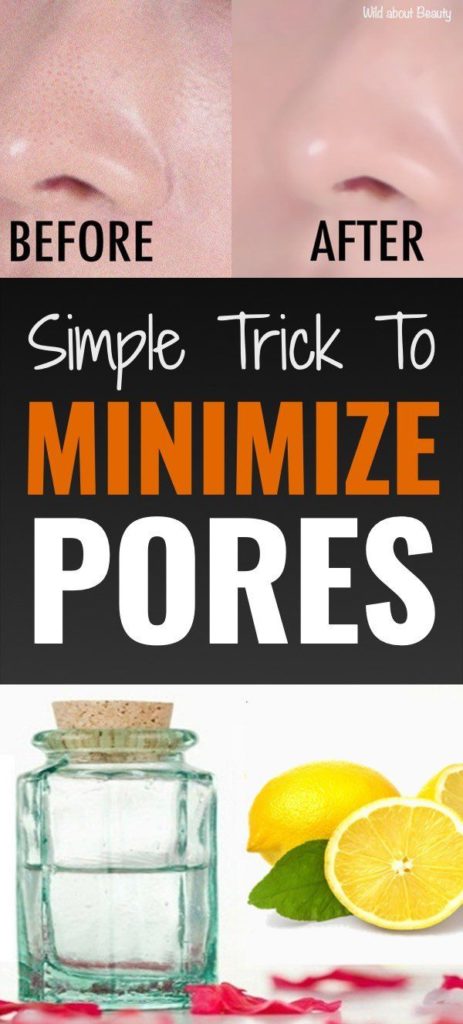 How To Minimize Pores Without A Touch Of Makeup