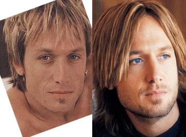 Keith Urban Plastic Surgery