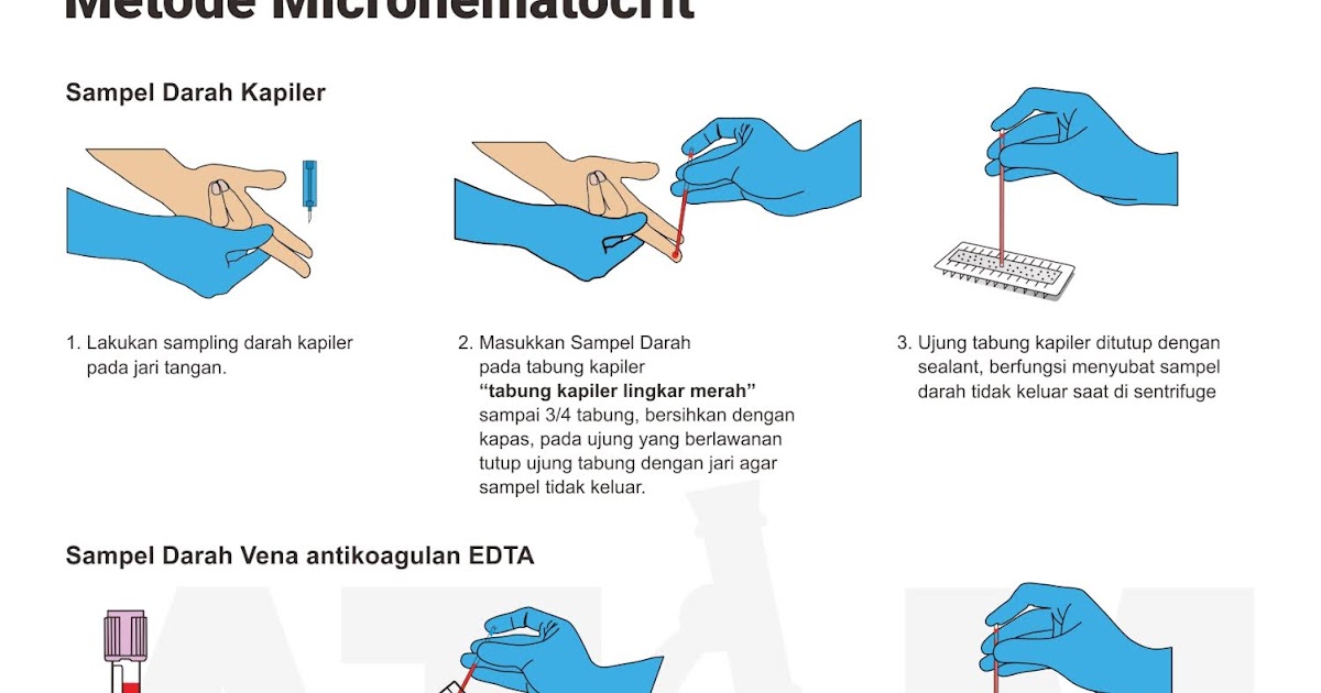 Pemeriksaan Hematokrit (Ht) Metode Mikrohematokrit — ATLM