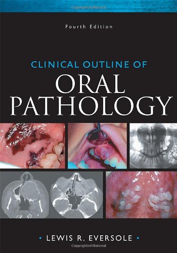 Clinical Outline of Oral Pathology: Diagnosis and Treatment