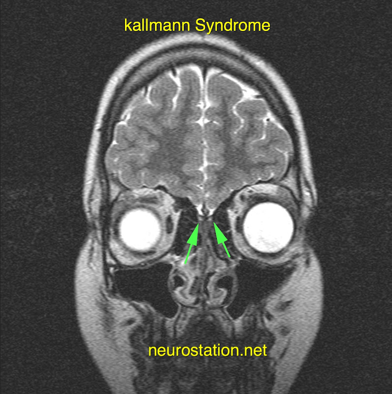 Neurostation: ENT-RADIOLOGY