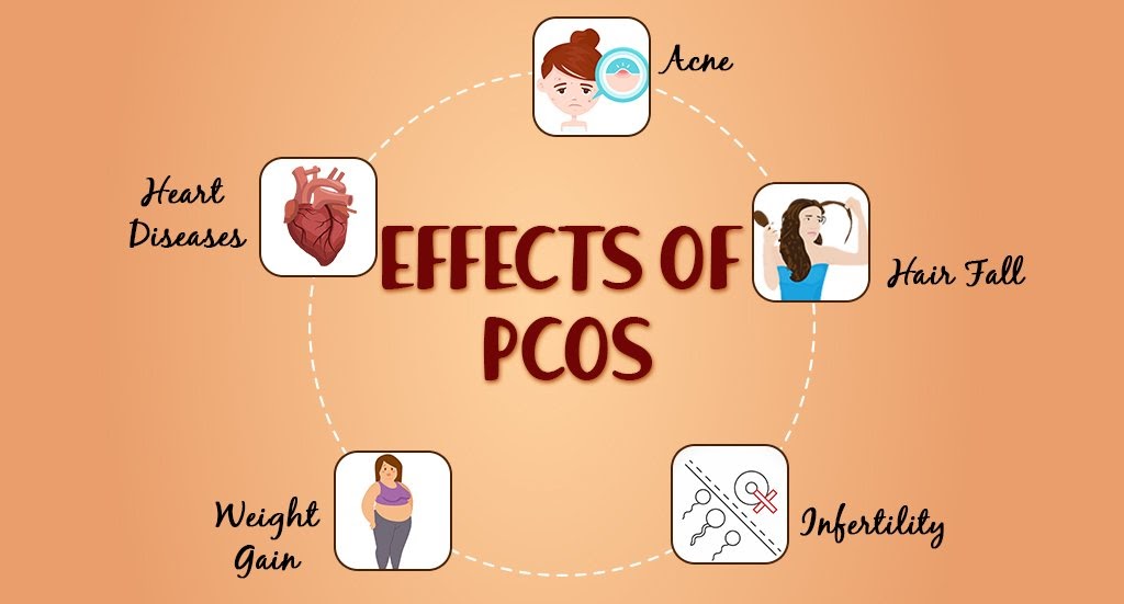 Everything You Need to Know About PCOS/PCOD