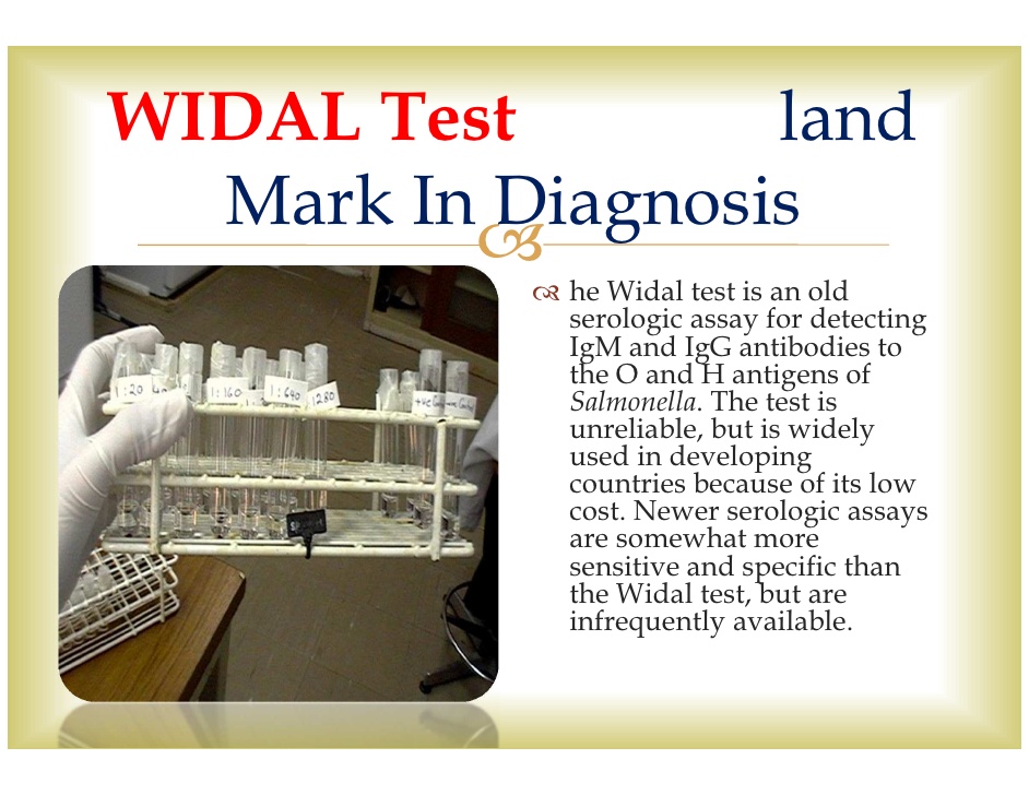 Widal test