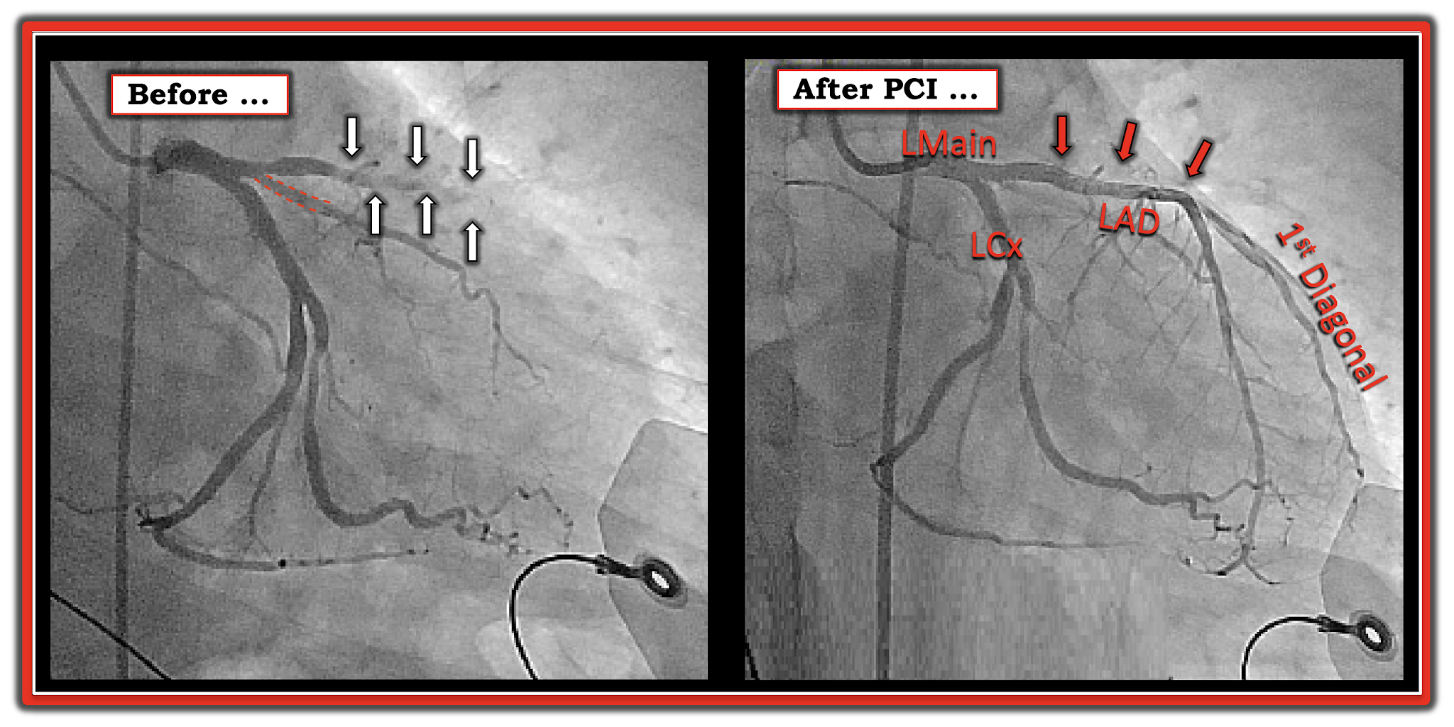 ECG Interpretation: ECG Blog #222 — Are Changes Dynamic?