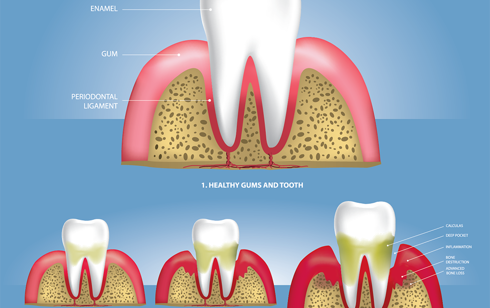 care of gingival tissue (9)