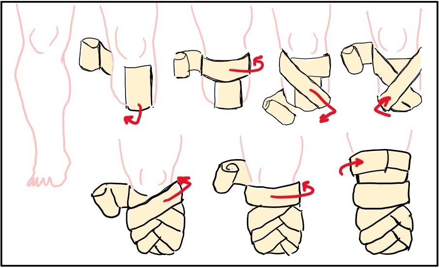 Medicowesome: Below Knee Amputation stump bandaging