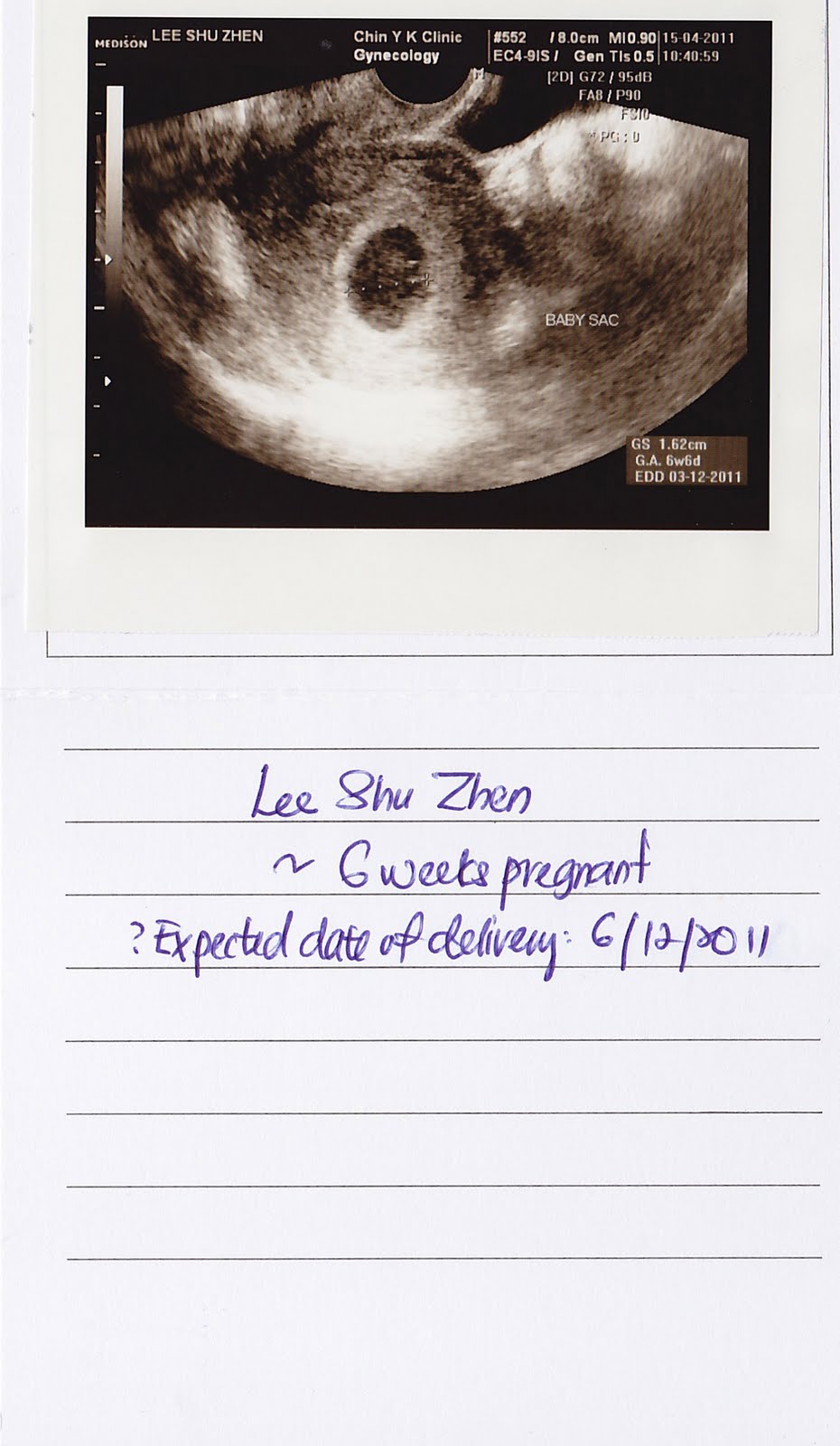 Our little Baby: Visit to the Gyane ( Dr Lisa Chin ) Gleneagles Hospital