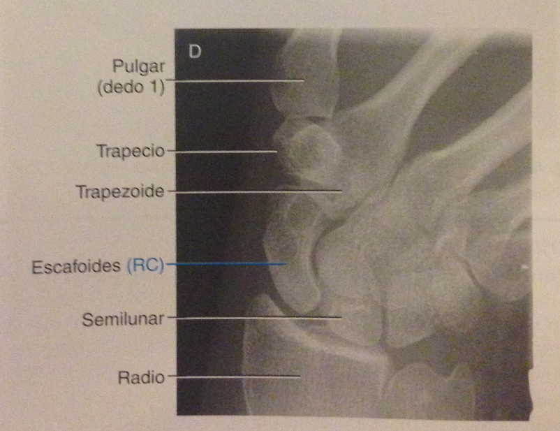 NOSOLOTECNICOS: PROYECCIÓN ESPECÍFICA DE ESCAFOIDES