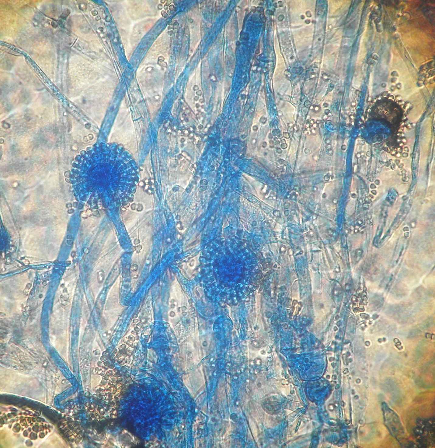 ATLAS MICOLOGIA: SYNCEPHALASTRUM RACEMOSUM