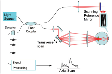 The Site for Healthcare Professionals: Optical Coherence Tomography (OCT)